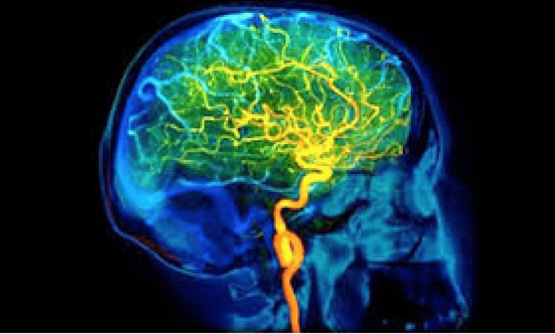 CogniShield Review – A Cure For Alzheimer's Disease?